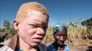 Ritual Killing In Africa | Human Rights, Rule of Law, and Superstition ...